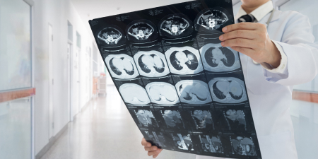 Renal Cancer Care | Dr. Aarthy P, Uro Surgeon, Chennai